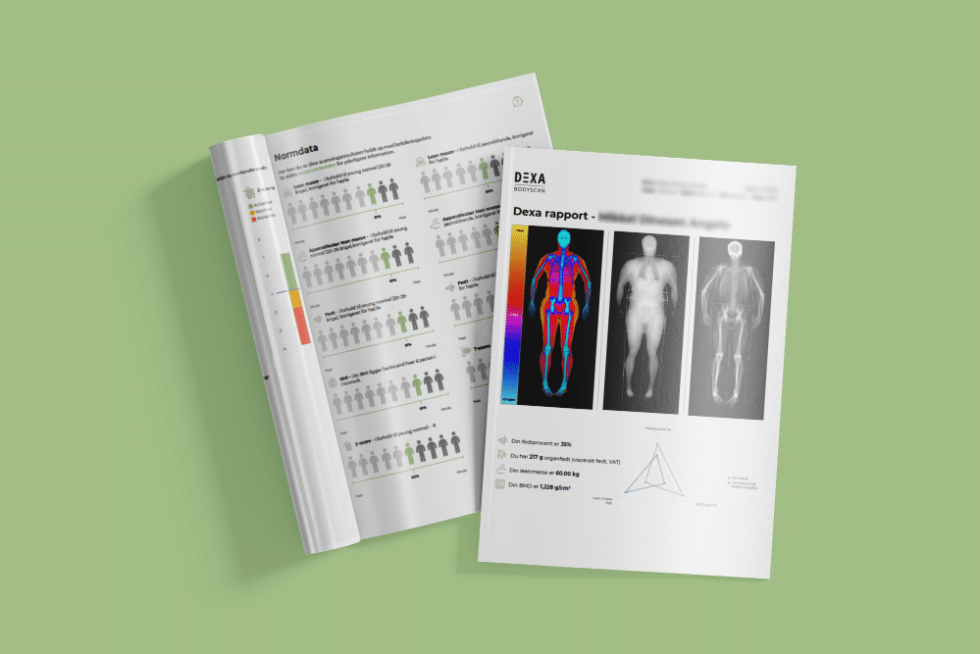 Understand your Dexa report | Dexa Bodyscan